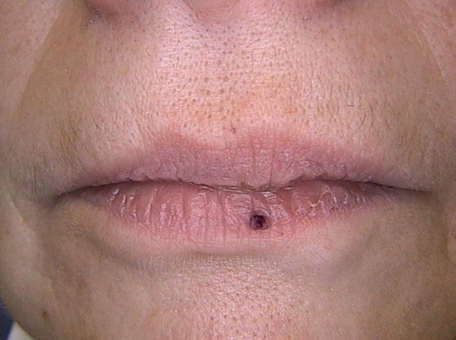 MeDioStar® Professional Diode Laser | Asclepion UK